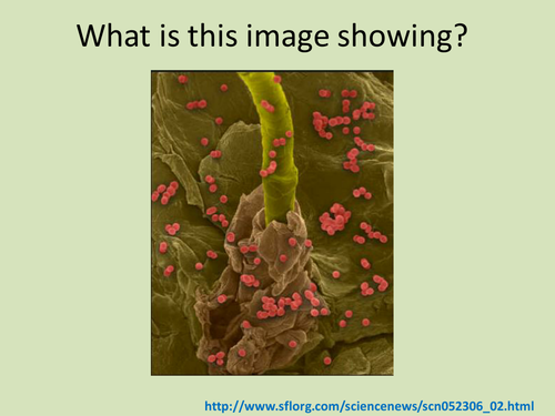 GCSE Core Science - Biology: Microbes and Disease - Lesson 2 - Defences ...