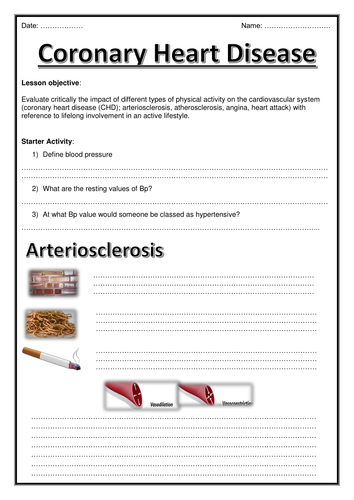 Coronary Heart Disease - The impact of physical activity on the ...