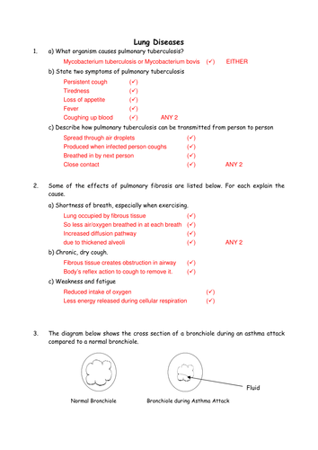 Biology: Lung diseases | Teaching Resources