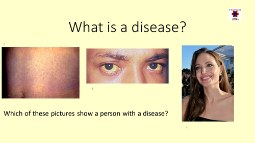 Health and Disease Resources GCSE2016 | Teaching Resources