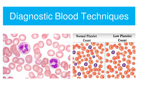 Diagnostic Blood Techniques for 16+ Biology courses | Teaching Resources
