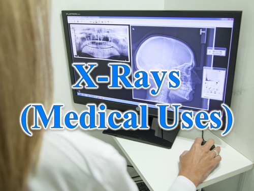 Phy_6.10 EMS - X-Rays | Teaching Resources