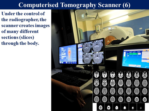 Phy_6.10 EMS - X-Rays | Teaching Resources