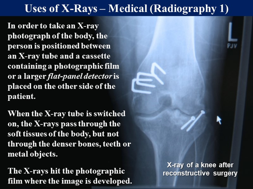 Phy_6.10 EMS - X-Rays | Teaching Resources