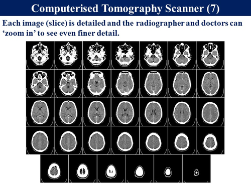 Phy_6.10 EMS - X-Rays | Teaching Resources