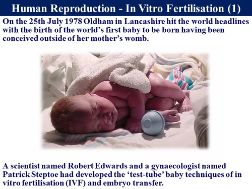 Child Development 1.2 - Infertility & IVF | Teaching Resources