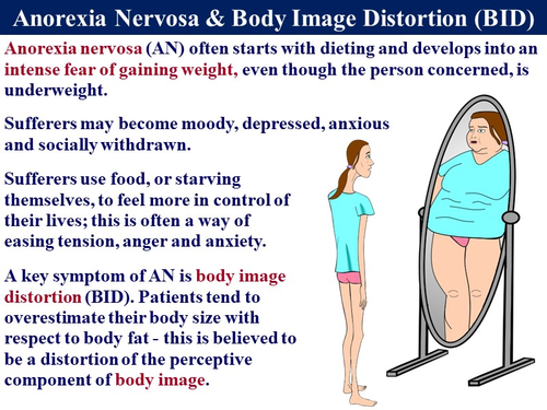Food_2.3 Eating Disorders - Bulimia and Anorexia | Teaching Resources