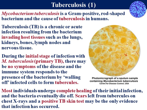 BioA_4.1.1 Pathogens - Tuberculosis (TB) | Teaching Resources
