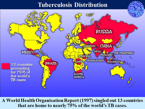 BioA_4.1.1 Pathogens - Tuberculosis (TB) | Teaching Resources