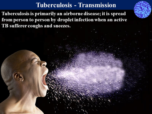 BioA_4.1.1 Pathogens - Tuberculosis (TB) | Teaching Resources
