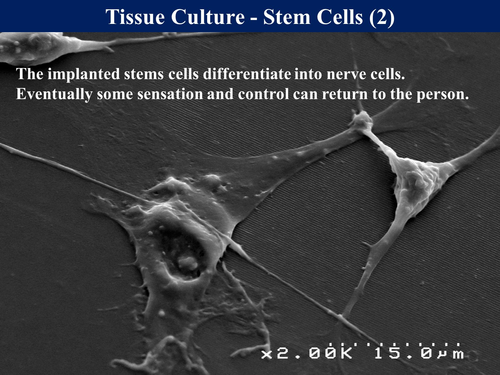 Bio1.7 Mitosis, Stem Cells & Cell Differentiation | Teaching Resources