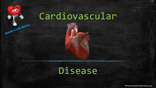 Cardiovascular Disease Powerpoint Presentation Teaching Resources