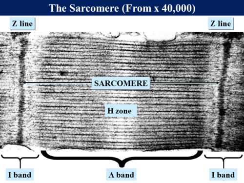 PE_A_Skeletal Muscle Structure - 1 | Teaching Resources