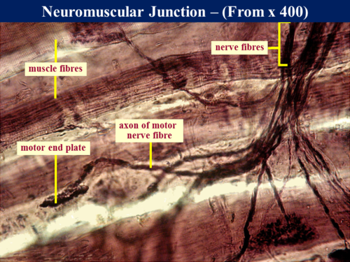 PE_A_Skeletal Muscle Structure - 2 | Teaching Resources