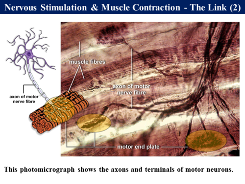PE_A_Skeletal Muscle Structure - 2 | Teaching Resources