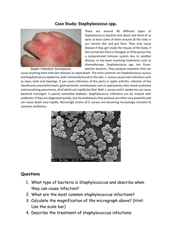 A-Level Biology Bacteria as pathogens (Edexcel Biology B Topic 6 ...