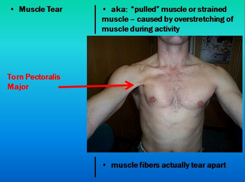 Muscular System Unit | Teaching Resources