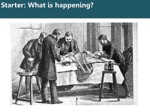 AQA GCSE 9-1 Health in the 1800s | Teaching Resources