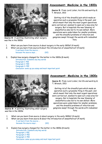 Medicine during the Industrial Revolution (6 lessons) | Teaching Resources