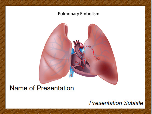 Pulmonary Embolism PowerPoint Template | Teaching Resources