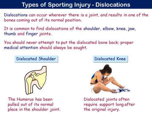 PE706ST - Types of Injury | Teaching Resources
