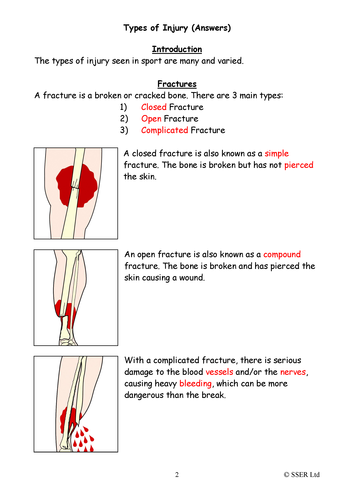 PE706ST - Types of Injury WS | Teaching Resources