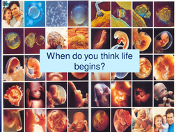 When does life begin? | Teaching Resources