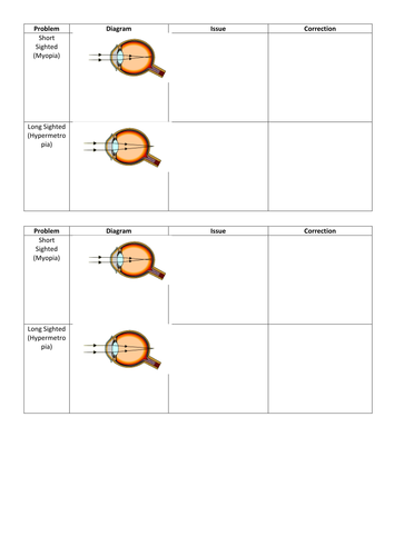 KS4 AQA GCSE Biology (Science) The Eye Lesson & Activities | Teaching ...