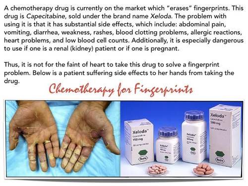 Fingerprint - Forensic - Evidence - Mayfield - McKie et al - 70 Slides ...