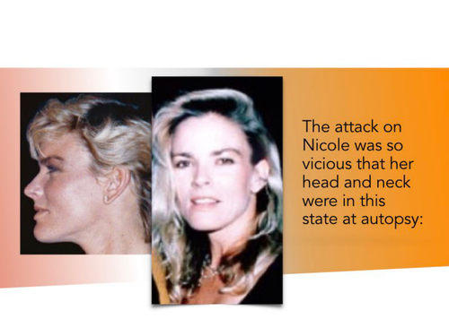 O.J. Simpson - 3 Cases - Compare Contrast Criminal Civil Law - Distance ...