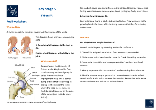 The Causes of FAI and Osteoarthritis- KS5 | Teaching Resources