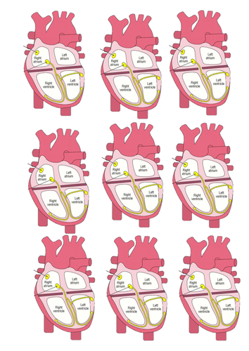 Heart, Vessels, Pacemaker, WHOLE LESSON resources - GCSE New 2016 ...