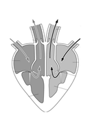 Heart, Vessels, Pacemaker, WHOLE LESSON resources - GCSE New 2016 ...