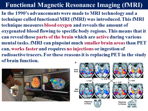 BioA_C.2.a. The Brain (Non-Invasive Study Techniques) | Teaching Resources