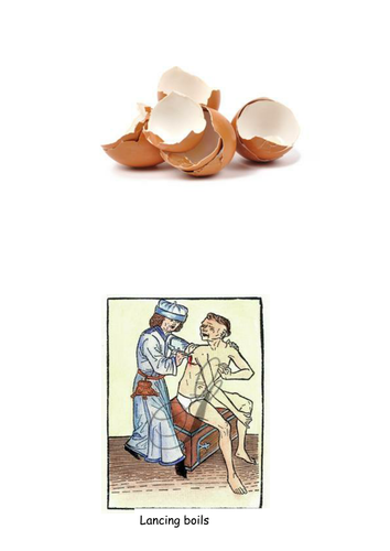 Black Death Causes - Natural vs Supernatural | Teaching Resources