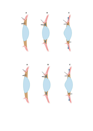 B10.6 Common problems of the eye | Teaching Resources