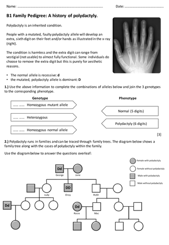 GCSE - Inheritance & Family Trees - Polydactyly | Teaching Resources