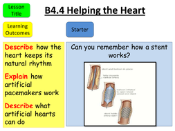 AQA GCSE B4.4 Helping the Heart | Teaching Resources
