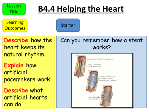 AQA GCSE B4.4 Helping the Heart | Teaching Resources