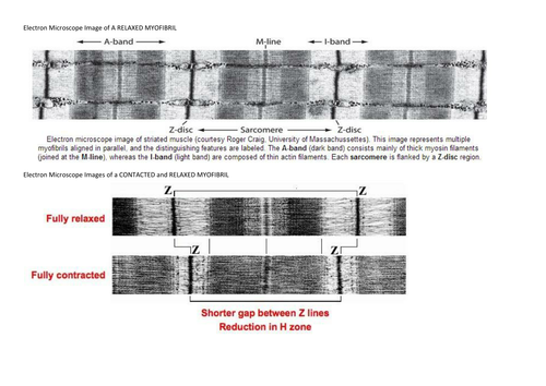 Muscle Contraction - AQA NEW Biology A-level spec | Teaching Resources