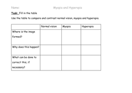 The Eye (Biology Only) - New AQA Biology GCSE | Teaching Resources