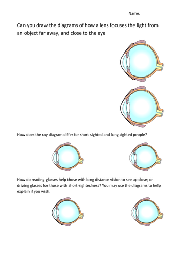 Common problems of the eye | Teaching Resources