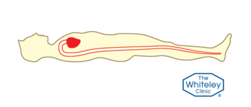 Blood vessels - complete lesson (GCSE 1-9) | Teaching Resources