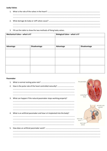 New GCSE 9-1 AQA Biology B4 Helping the Heart | Teaching Resources
