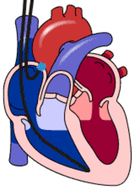 Helping the heart - complete lesson (GCSE 1-9) | Teaching Resources