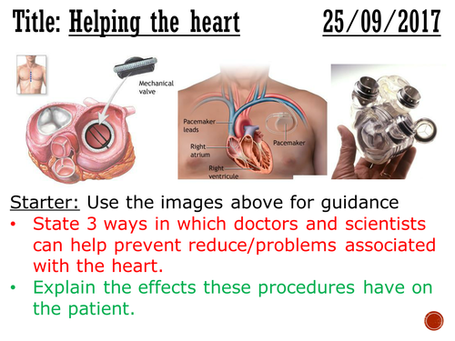 Helping the heart - complete lesson (GCSE 1-9) | Teaching Resources
