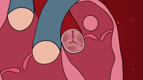 Helping the heart - complete lesson (GCSE 1-9) | Teaching Resources