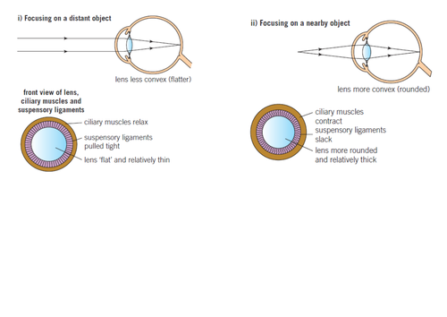B10.5 B10.6 The eye and complications | Teaching Resources