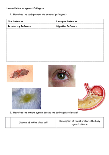 New Biology GCSE B5 Human Defence Responses | Teaching Resources
