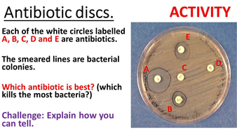 Antibiotics, medicines, Alexander Fleming, discovery of penicillin ...